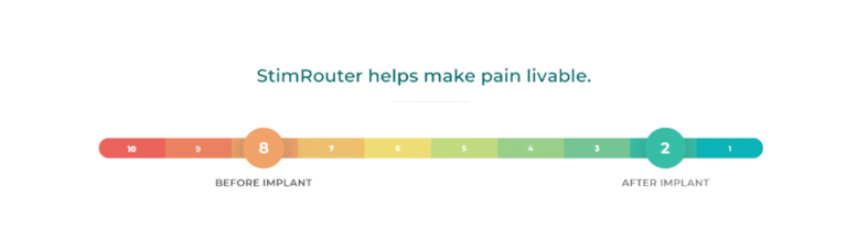 Patients StimRouter for Chronic Pain – StimRouter